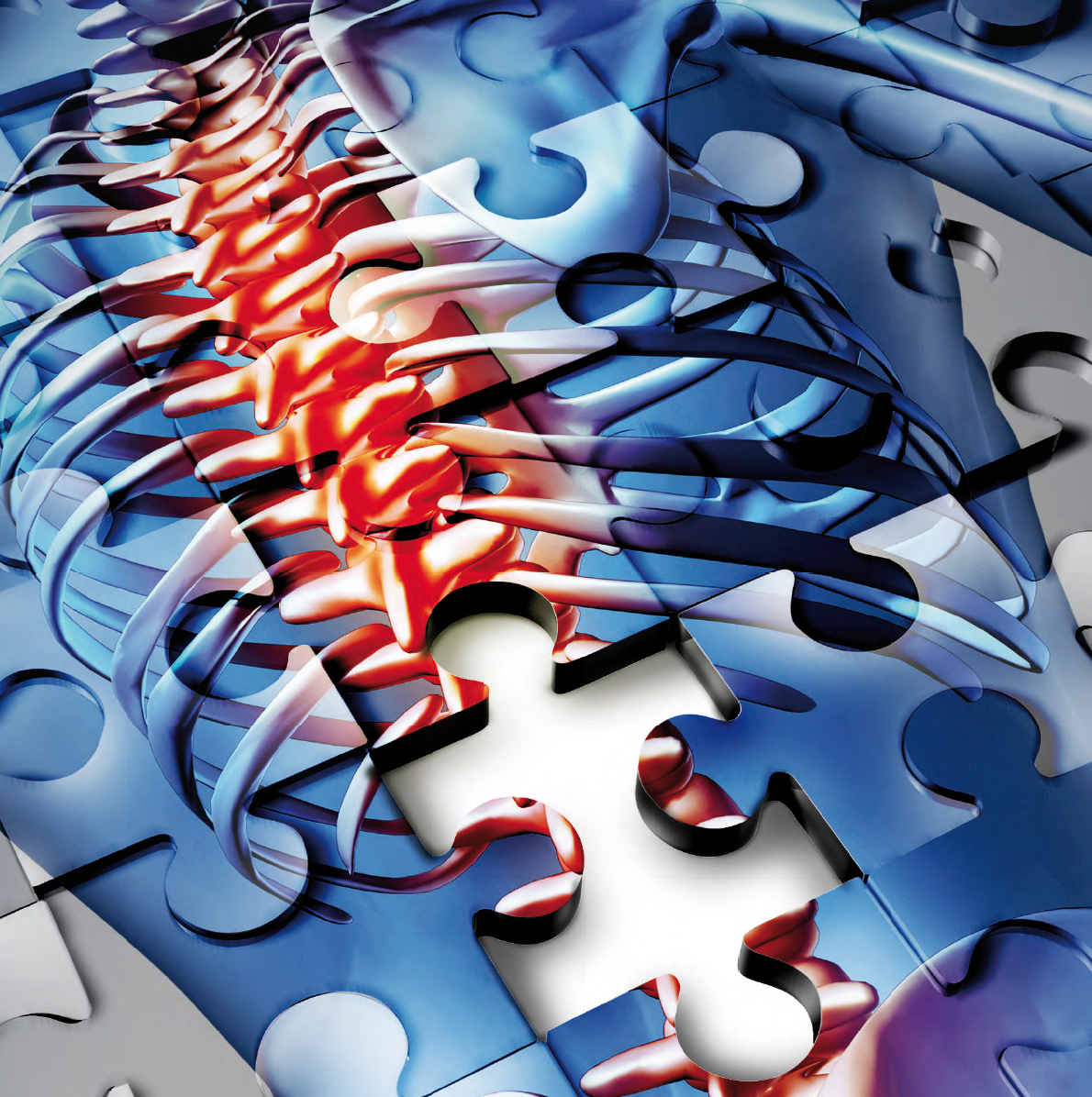 The Polytrauma Puzzle - TBI Times
